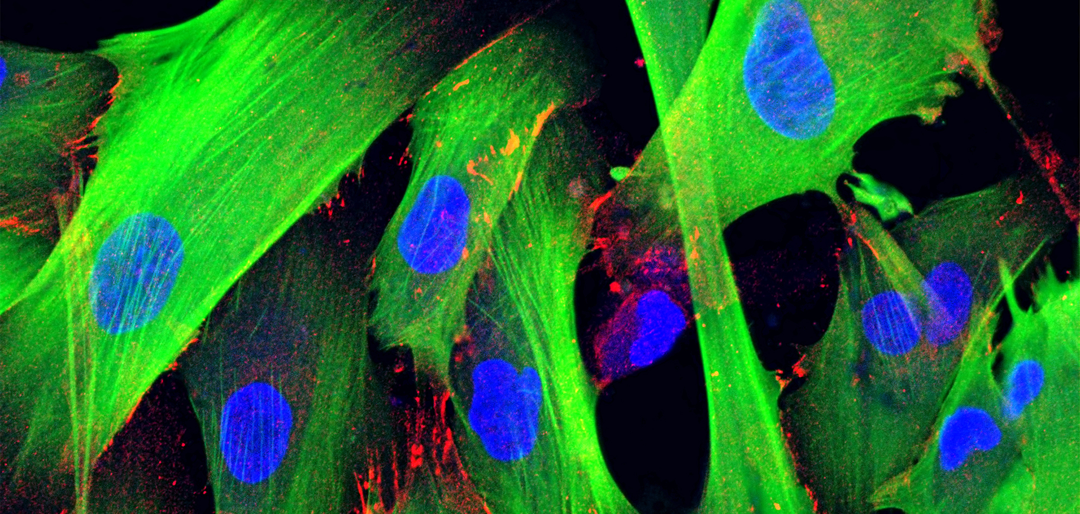 Mechanism of Action Characterisation Using Cell Painting Techniques