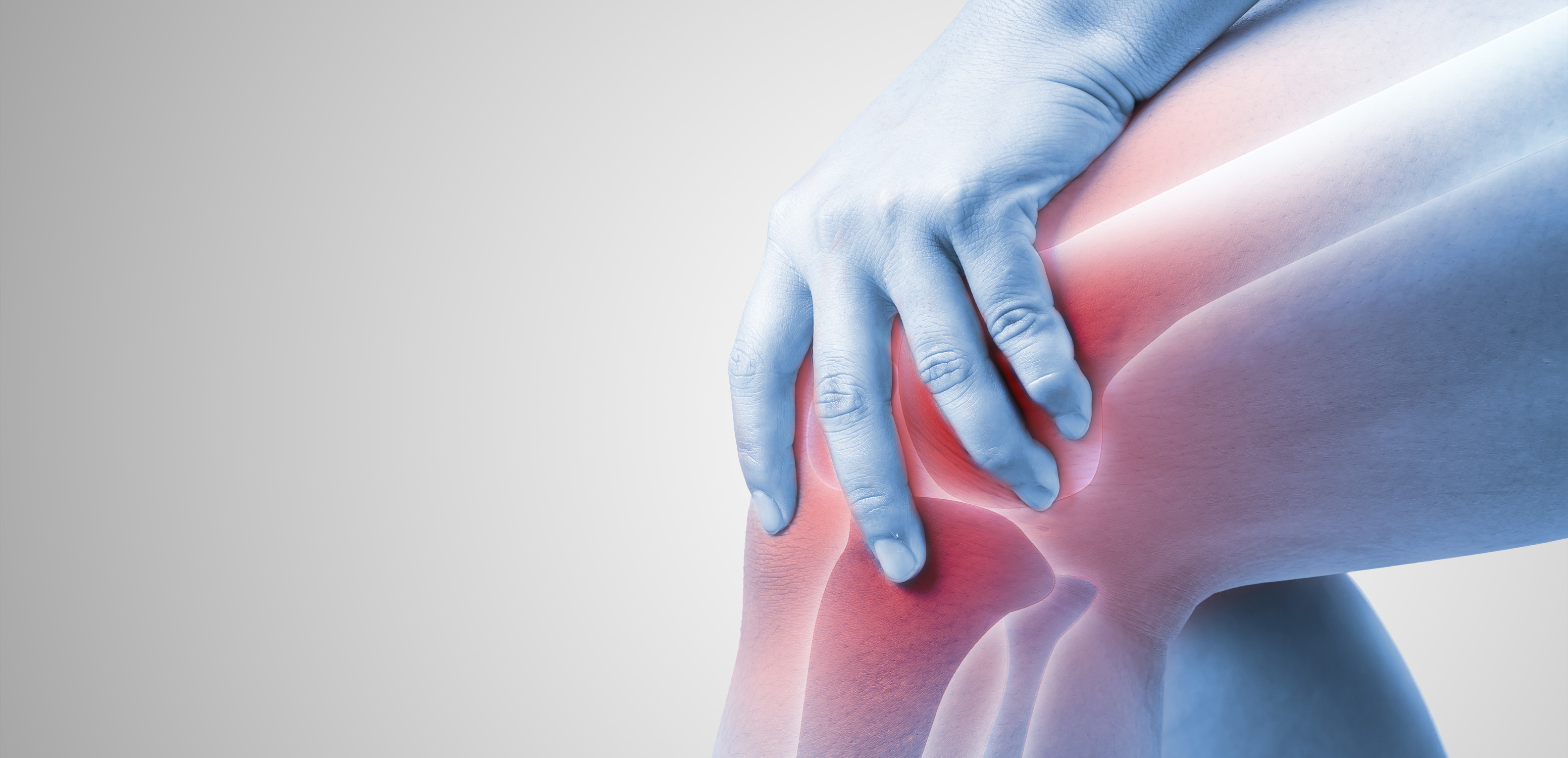 Joint Count Comparison of Chikungunya Arthritis with Rheumatoid Arthritis