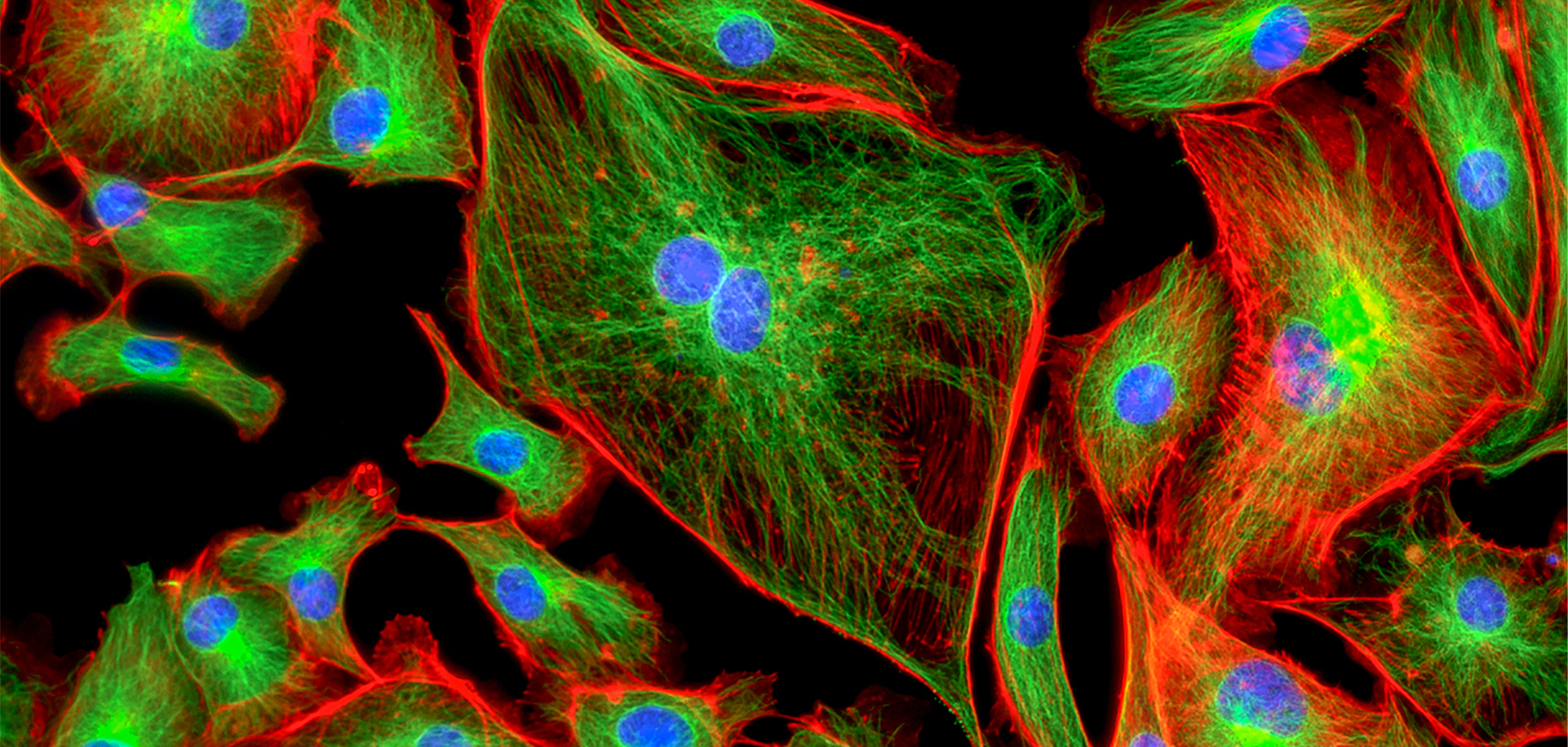 In-depth Cellular Analysis using Cell Painting